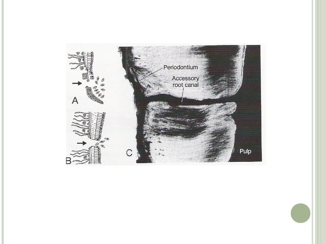 Root Formation root-formation