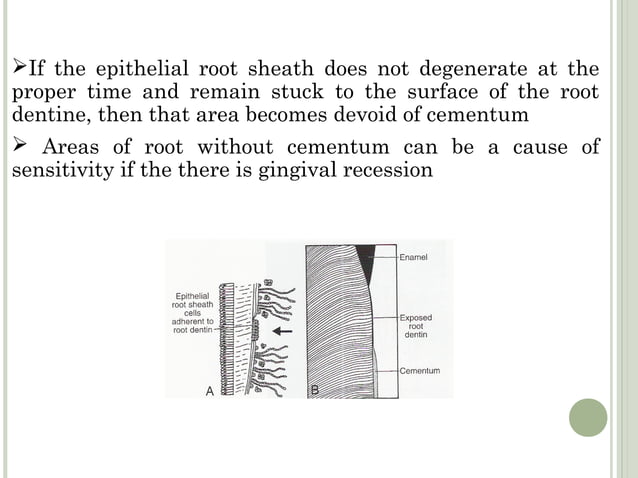 Root formation
