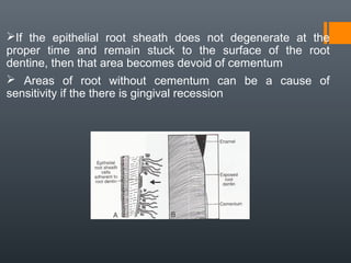 Root formation | PPT