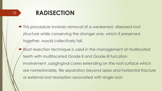 ROOT FRACTURES AND ITS MANAGEMENT | PPTX | PPTX