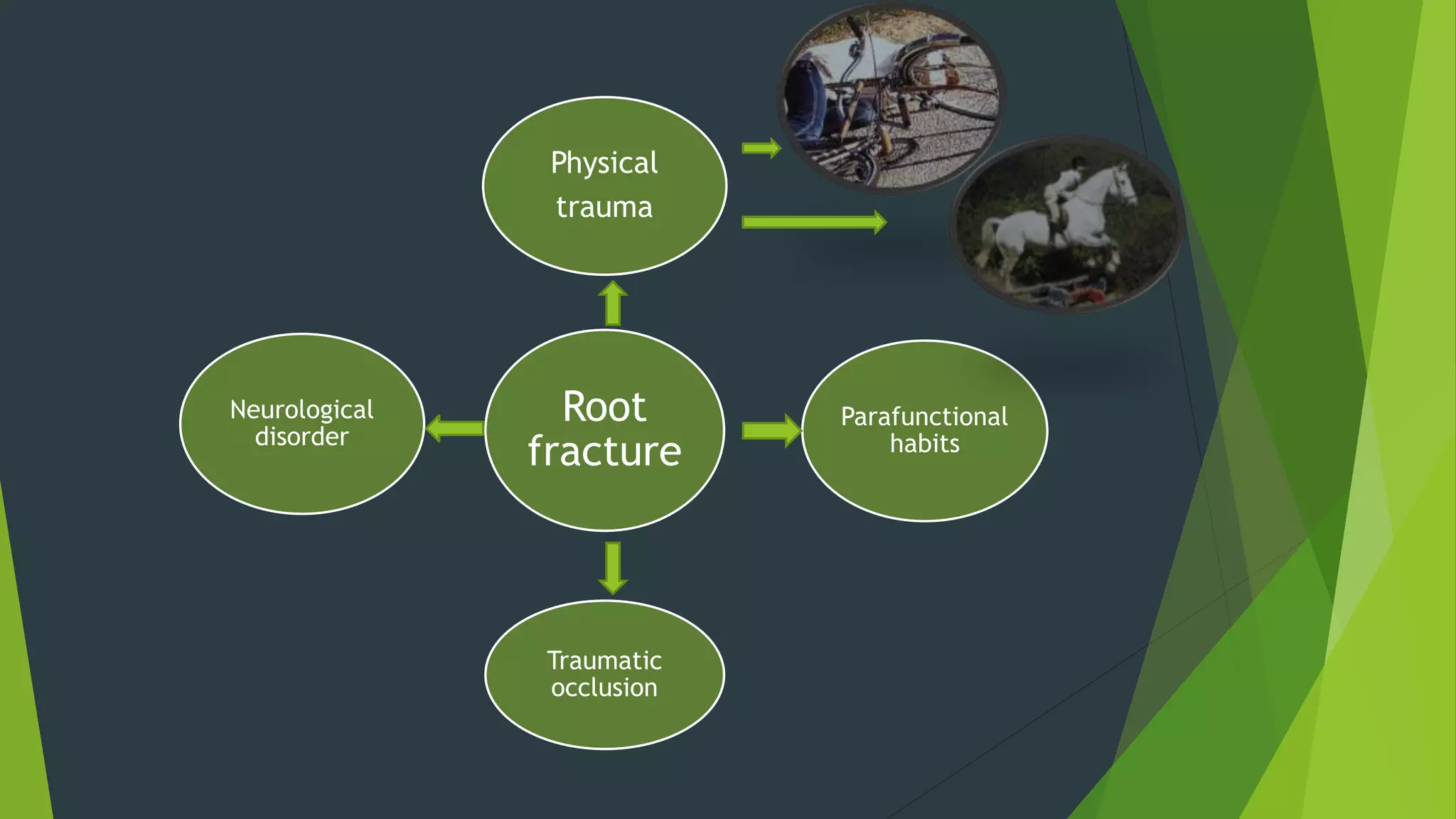 Root fractures and its management | PPTX