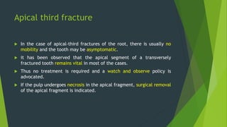 Root fractures and its management | PPTX