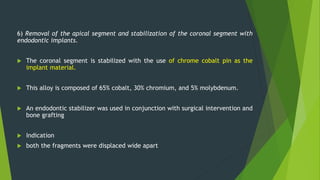 Root fractures and its management | PPTX