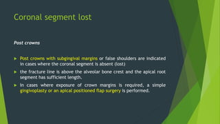 Root fractures and its management | PPTX