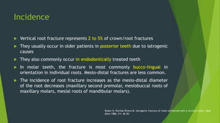 Root fractures and its management | PPTX