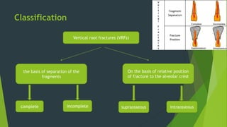 Root fractures and its management | PPTX