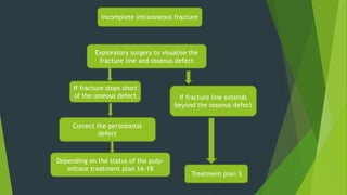 Root fractures and its management | PPTX