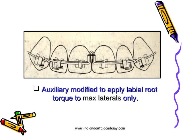 Root movement in orthodontics | PPT