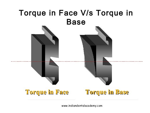 Root movement in orthodontics