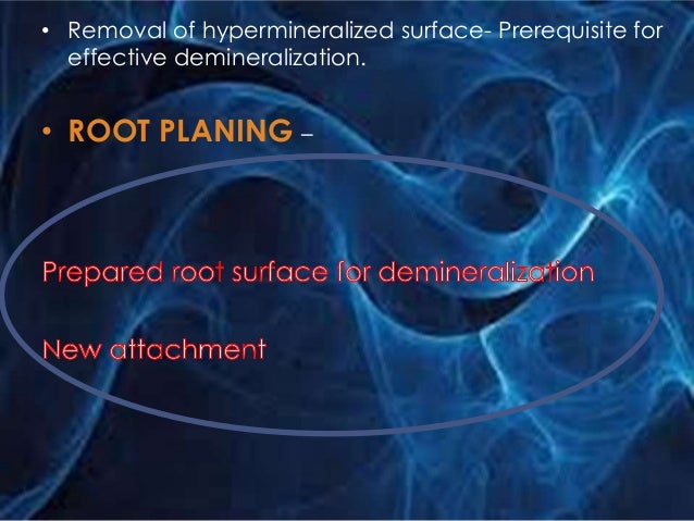 Root planing