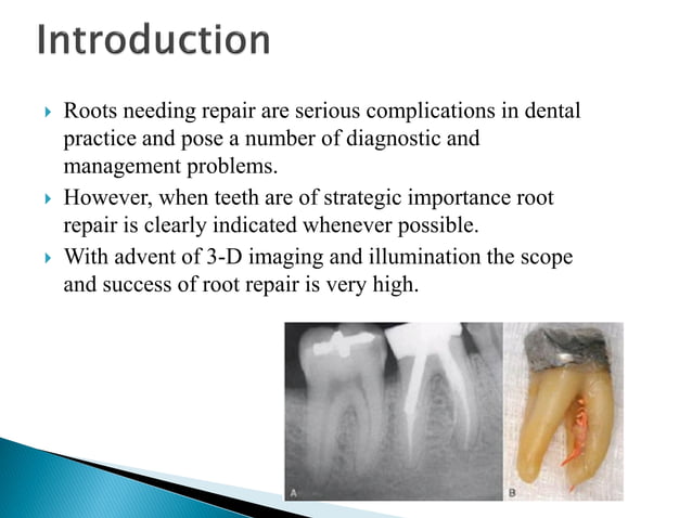 Root repair materials | PDF