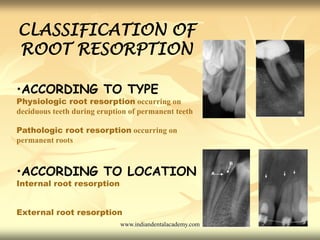 Root resorption /certified fixed orthodontic courses by Indian dental ...