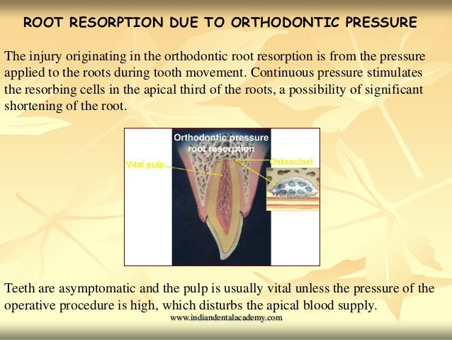 Root resorption /certified fixed orthodontic courses by Indian dental…