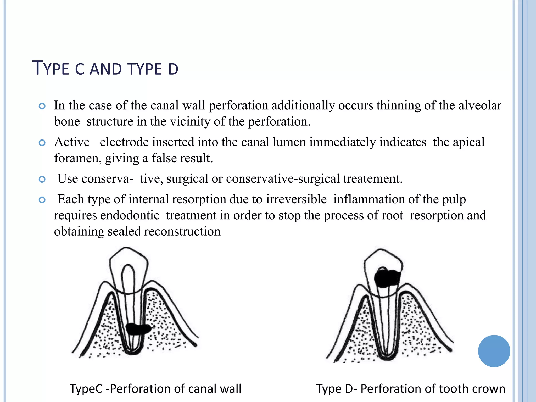 Root resorption | PPTX