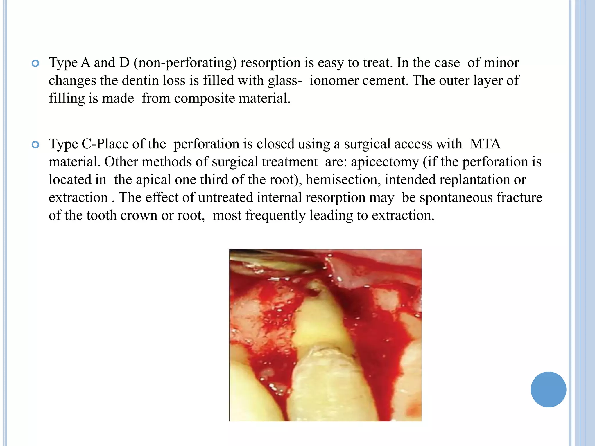 Root resorption | PPTX
