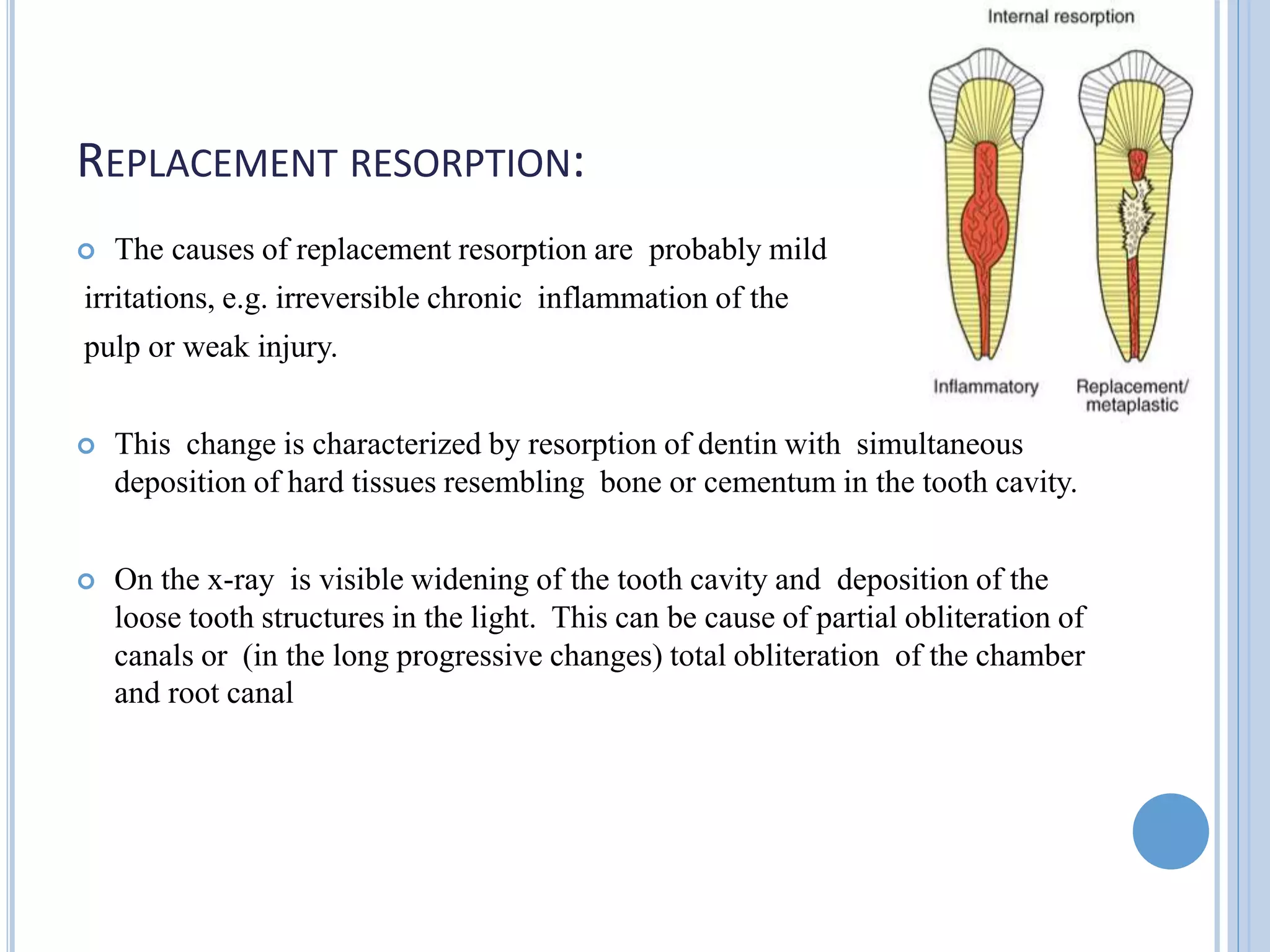 Root resorption | PPTX