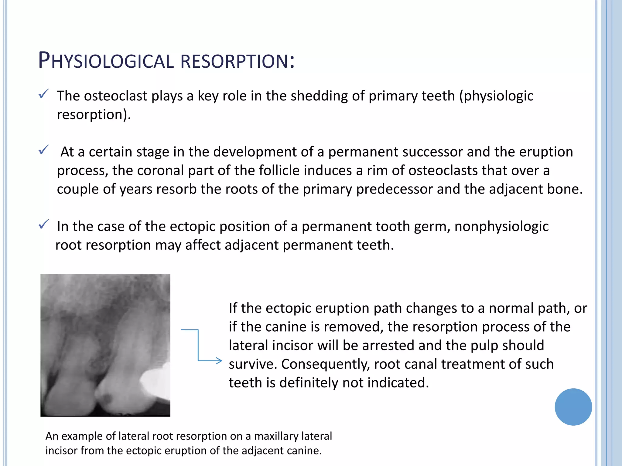 Root resorption | PPTX