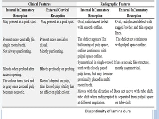 External Resorption Vs Internal Resorption