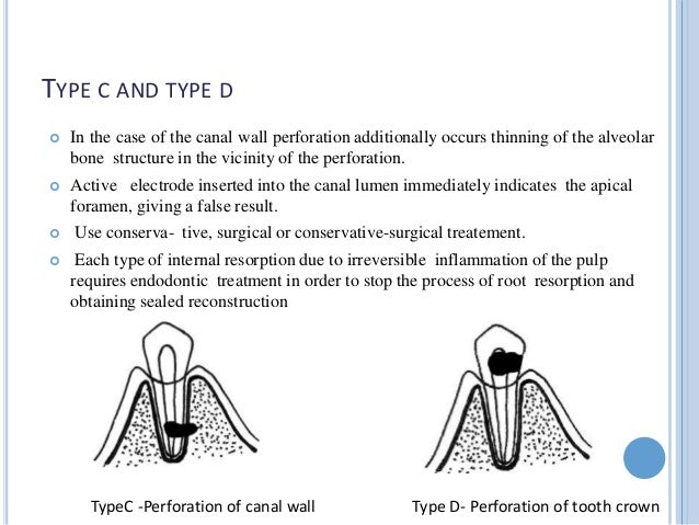 Root resorption