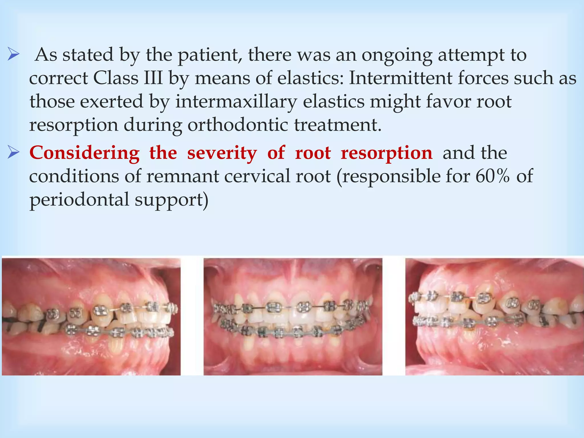 Orthodontics Management of root resorption _ Departement orthodontic ...