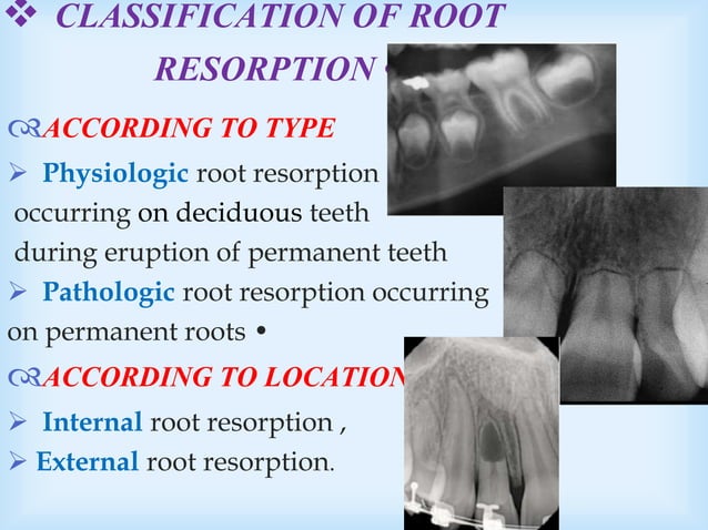 Orthodontics Management of root resorption _ Departement orthodontic ...