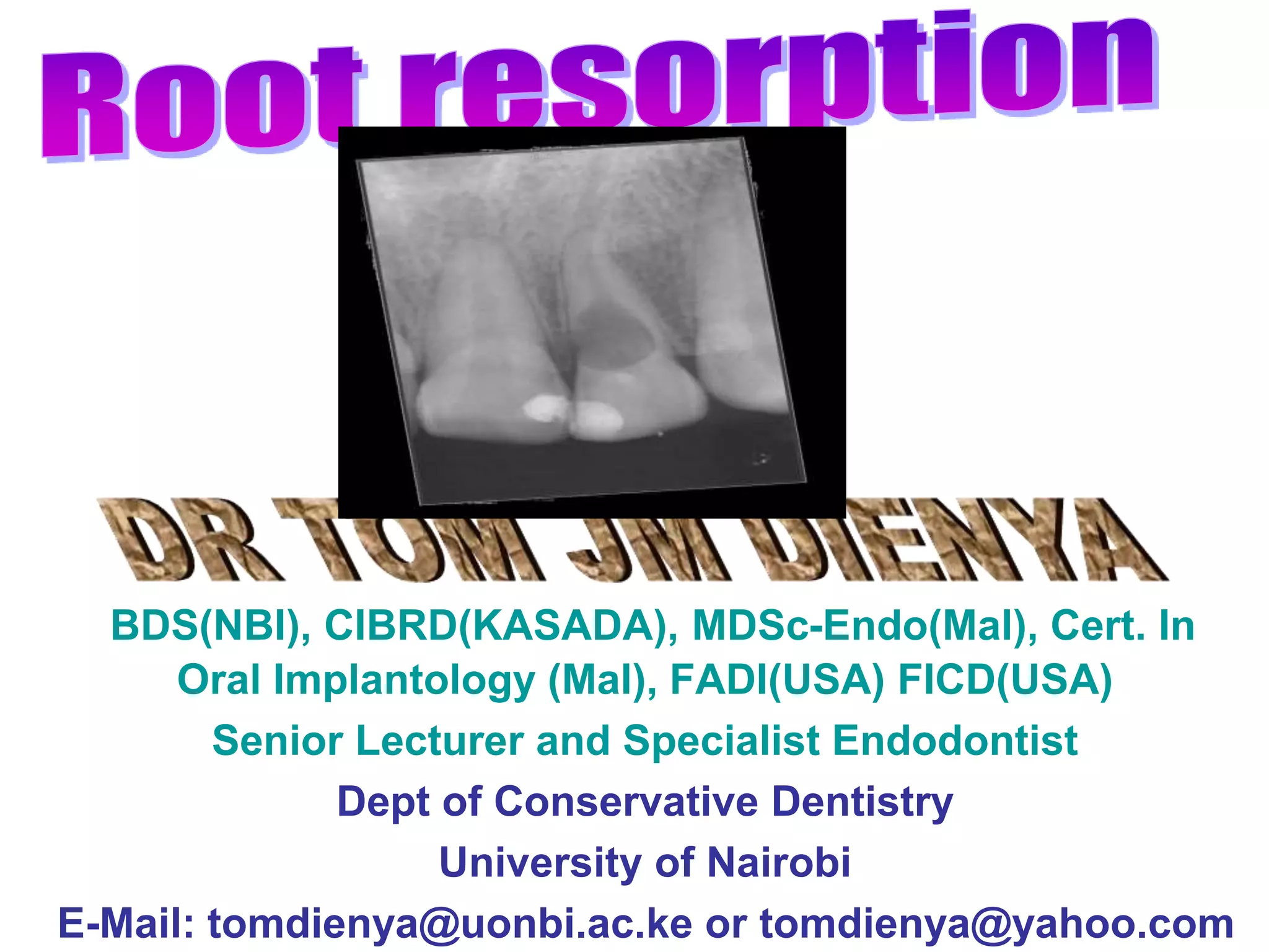 ROOT RESORPTION BDS 5.ppt