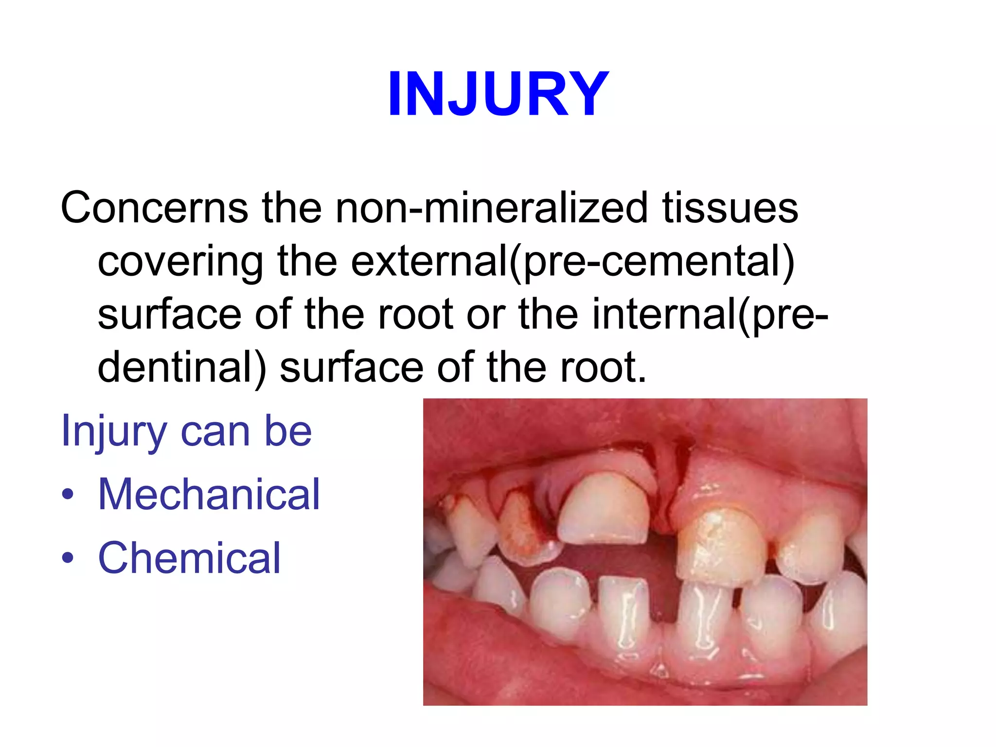 Root Resorption Bds 5ppt