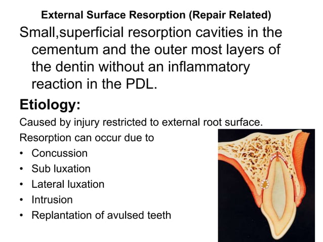 ROOT RESORPTION BDS 5.ppt