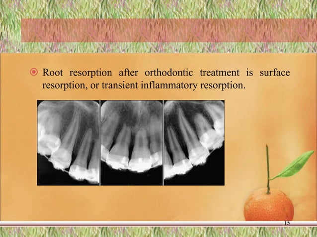 ROOT RESORPTION IN ORTHODONTICS | PPT | Bone and Joint Conditions ...
