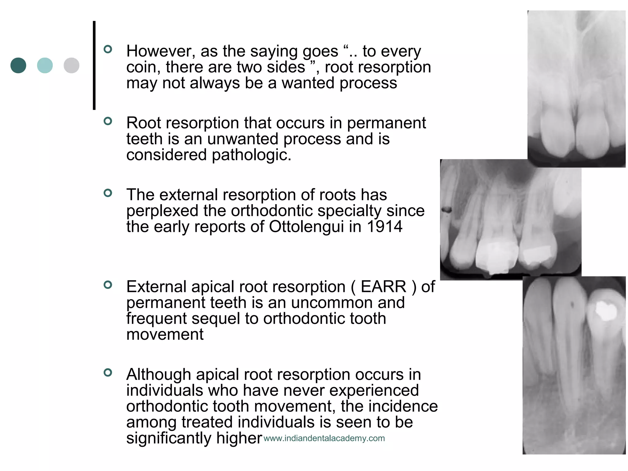 Root resorption in orthodontics /certified fixed orthodontic courses by ...