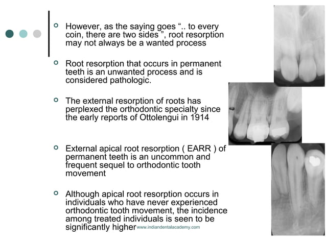 Root resorption in orthodontics /certified fixed orthodontic courses by ...