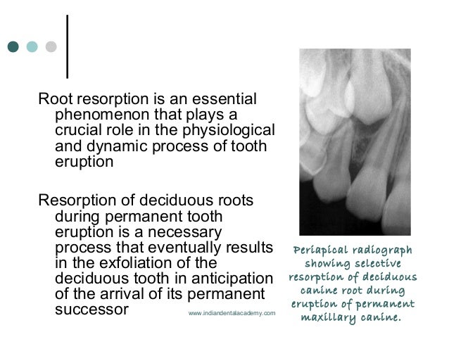 Root resorption in orthodontics /certified fixed orthodontic courses…