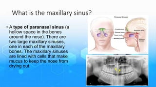 Management of root entrapment in maxillary sinus .pptx