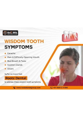 Are Wisdom Teeth Getting You Down | Rootz Dental | PDF