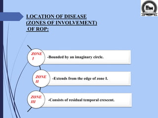 Retinopathy of pre-maturity (ROP) | PDF