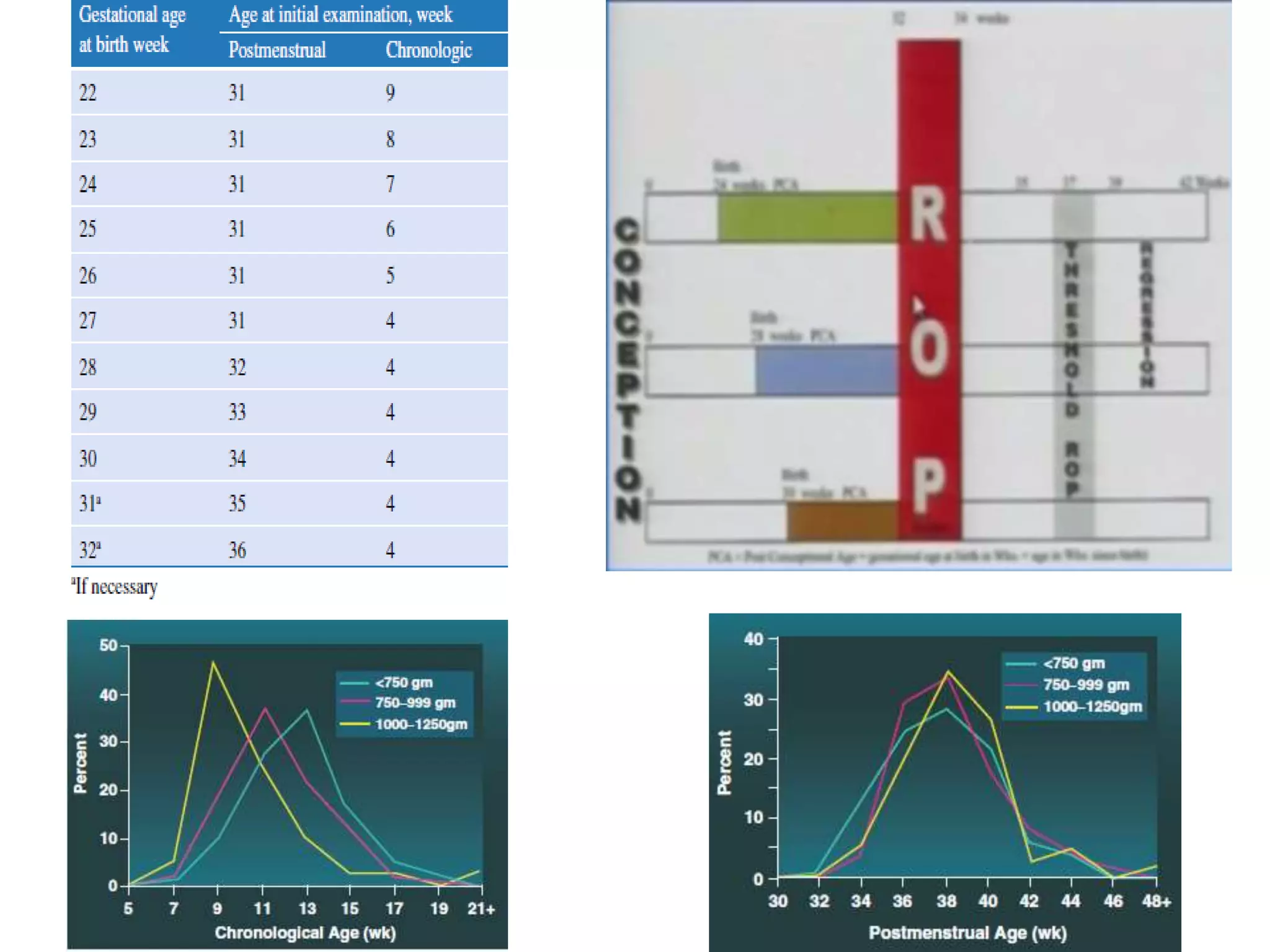 Rop Retinopathy of prematurity | PPT