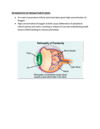 RETINOPATHY OF PREMATTURITY (ROP) PREVENTIVE MEASURES | DOCX