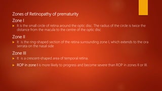 RETINOPATHY OF PREMATURITY | PPT