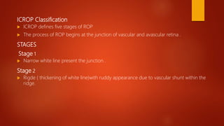 RETINOPATHY OF PREMATURITY | PPT