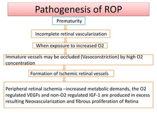 Retinopathy of Prematurity | PPTX