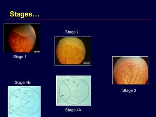 Rop case series- DR AJAY DUDANI | PPT