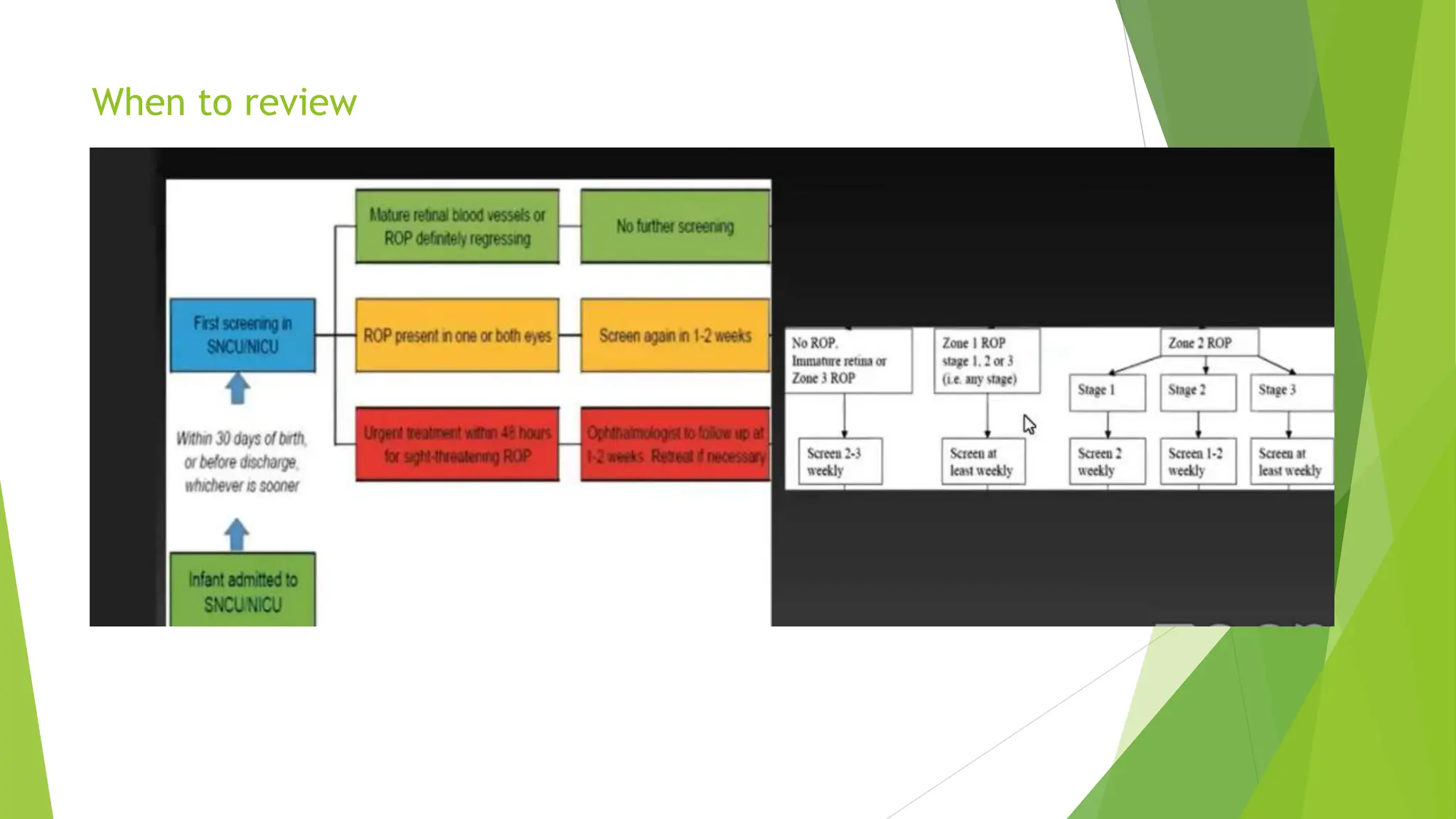 Retinopathy of Prematurity (ROP) - classification and treatments | PPTX