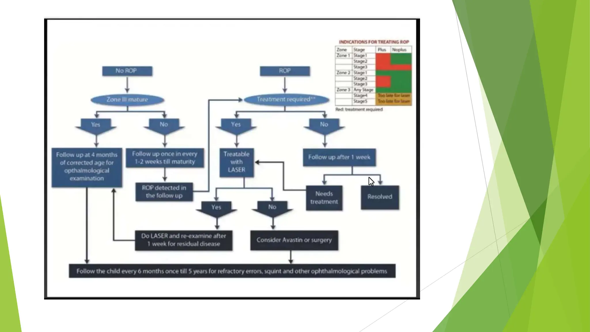 Retinopathy of Prematurity (ROP) - classification and treatments | PPTX