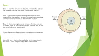 Retinopathy of Prematurity (ROP) - classification and treatments | PPTX