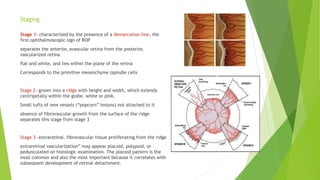 Retinopathy of Prematurity (ROP) - classification and treatments | PPTX