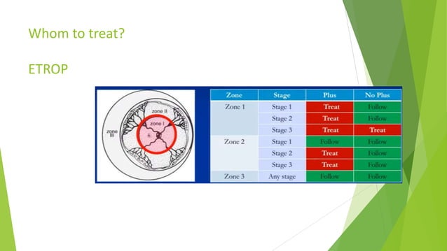 Retinopathy of Prematurity (ROP) - classification and treatments | PPTX