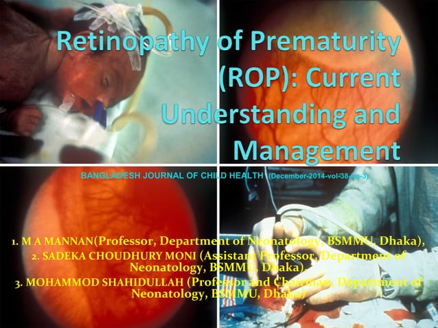 ROP current understanding and management | PPT