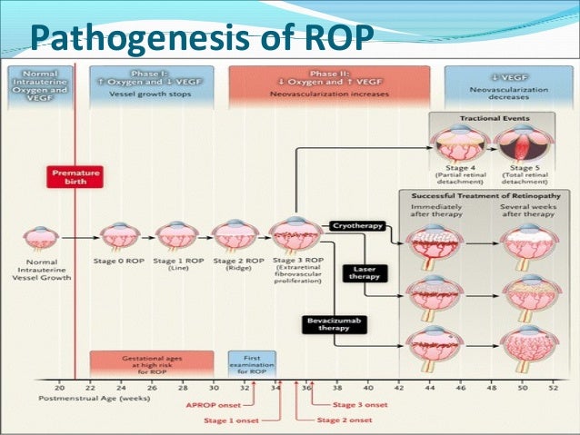 ROP current understanding and management