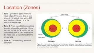 Retinopathy of Prematurity | PPT