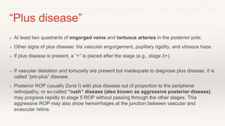 Retinopathy of Prematurity | PPT